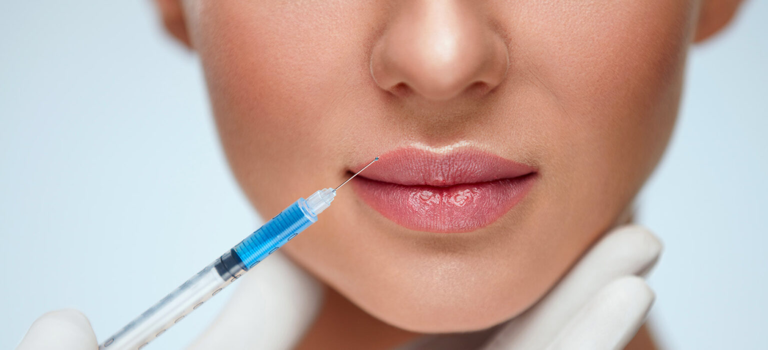 Actualité - Redessiner les lèvres grâce aux injections d’acide ...