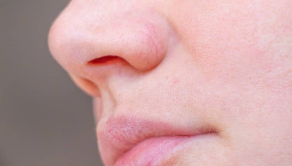 Comment traiter ses rougeurs sans chirurgie ? | Dr Mayeux | Paris