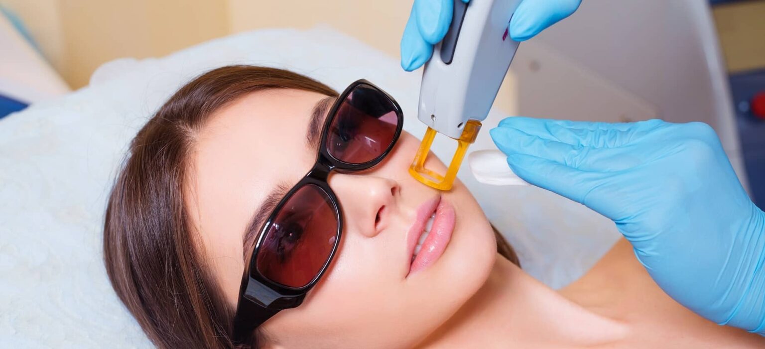 Les poils du visage: Épilation laser, laser Q Switched ou épilation ...