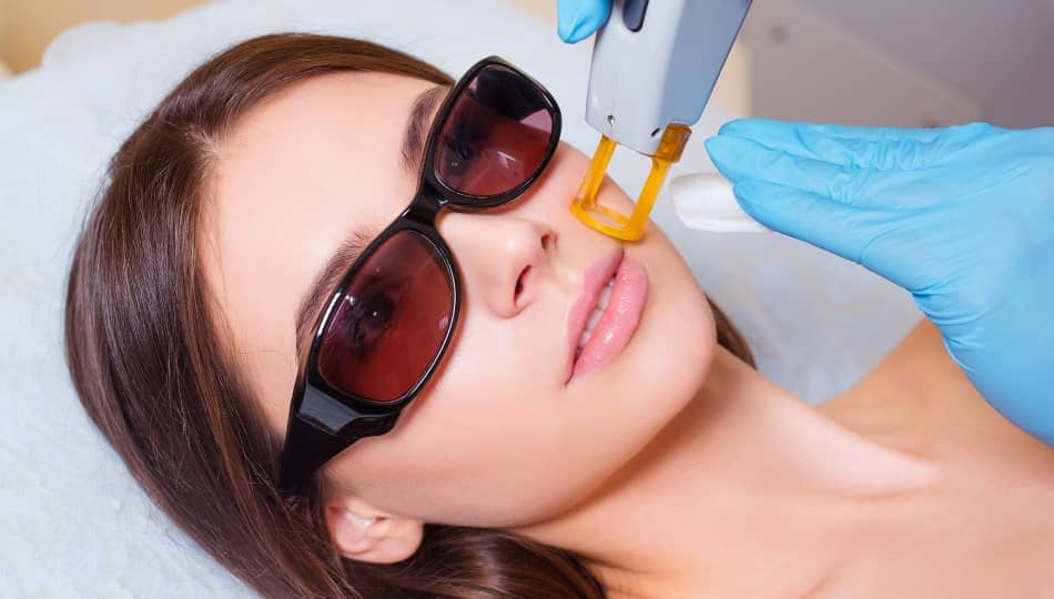 Les poils du visage: Épilation laser, laser Q Switched ou épilation électrique ? | Dr Mayeux | Paris